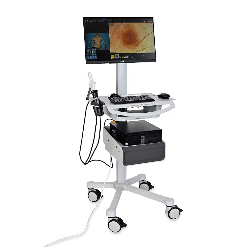Diagnostic video-rectoscope on a mobile cart - Bechtold